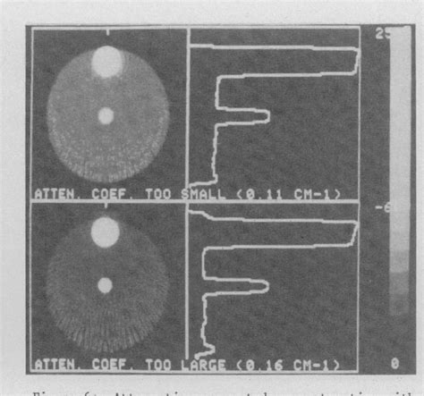Figure 4 From Inversion For The Attenuated Radon Transform With