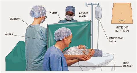Caesarean Section ~ Nursing
