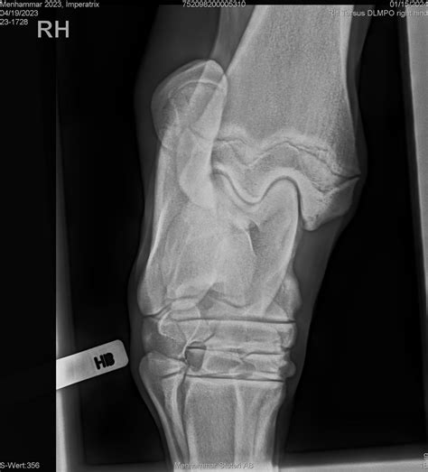 Imperatrix Menhammar Onlinesales