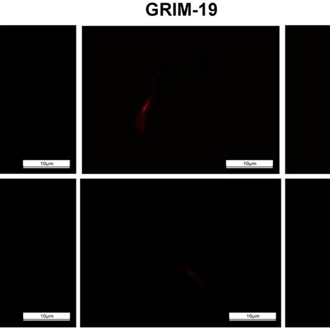 Immunofluorescent Staining Was Carried Out To Investigate The Download Scientific Diagram