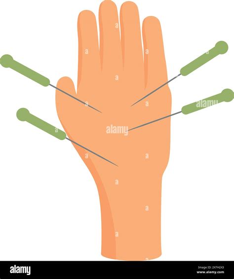 Vector Illustration Of Acupuncture Hand Model For Educational