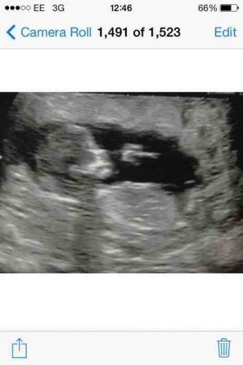 Nub Theory Is It The Thing That Looks Like A Fork Picture