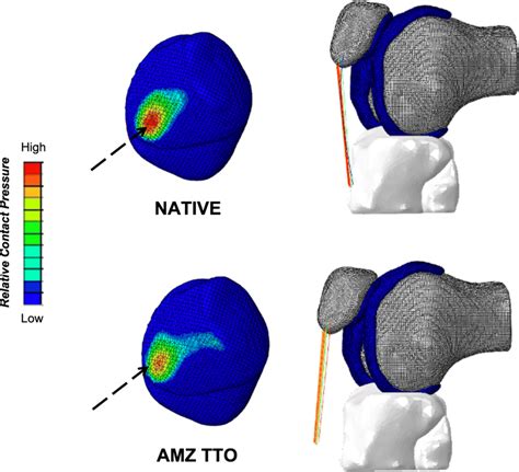 Preliminary Sample Finite Element Analysis Fea Model Demonstrating Download Scientific