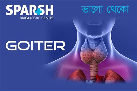 Goiter Sparsh Diagnostic Center