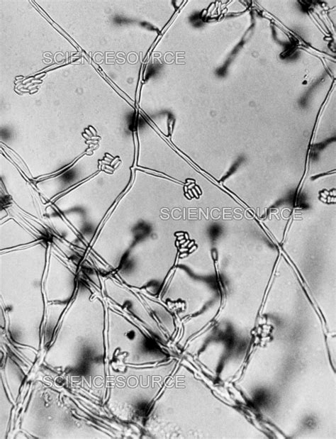 Penicillium Fungi Microscope