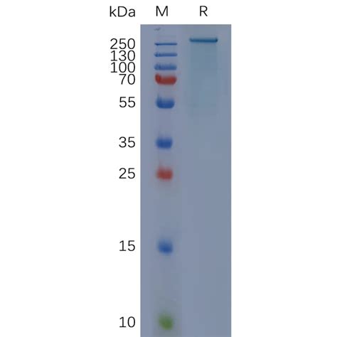 Recombinant Human Fibronectin Protein 6xhis Tag A317912