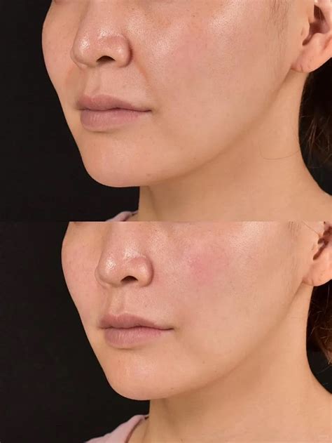 法令纹分享来噜～ 花瓣网