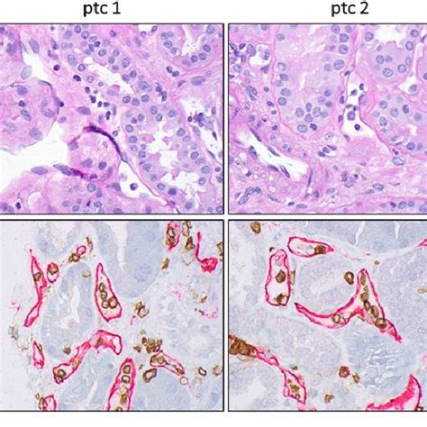 Peritubular Capillary Inflammatory Cells Margination Peritubular