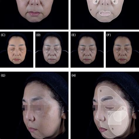 Relation Between The Coefficient Of Correlation Of The Predictive Model