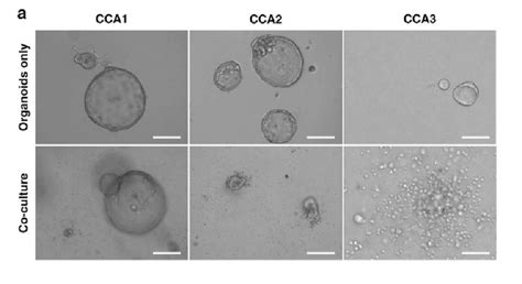 一篇关于肿瘤类器官和t细胞免疫共培养的文章（胆管癌和t细胞） 知乎