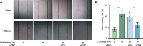 Blocking Akt2 Attenuates Diabetes Induced Rpe Cell Migration Human Download Scientific Diagram