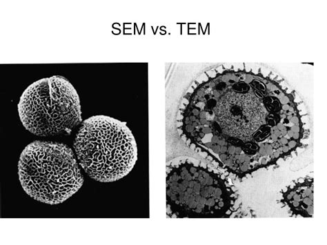 Tem Vs Sem Microscopy