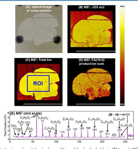 Figure 4 From A New Method And Mass Spectrometer Design For Tof Sims