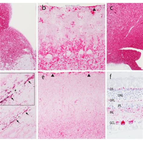 Accumulation Of Prp Sc In The Central Nervous System Representative Download Scientific
