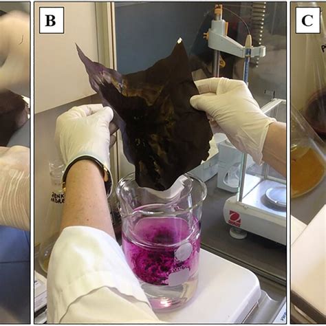 Microscopic Views Of Corified Skin In Weigerts Resorcin Fuchsin Rfw Download Scientific