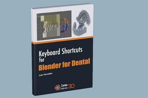 Diseño De Barras Y Prótesis Híbridas Con B4d Ibar