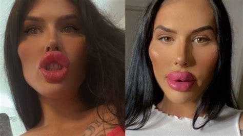 Filler Bibir Rp700 Juta Wajah Model Cantik Ini Dicibir Monster