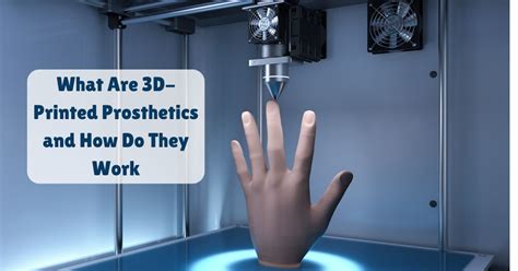 What Is A Transtibial Prosthesis Below Knee What Is A Transtibial Prosthesis Below Knee