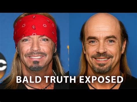 Is Bret Michaels Bald Under That Bandana