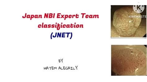 Japan Nbi Expert Team Classification Jnet