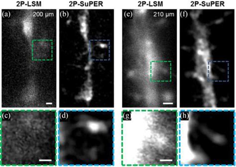 Ex Vivo Comparison Between A 2p Lsm And B Resonant 2psuper Imaging