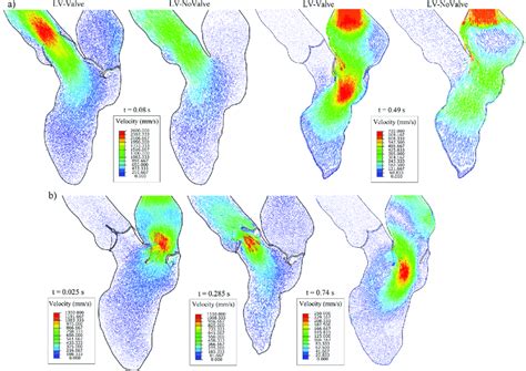 A Velocity Vector Fields In The Anterior Posterior Plane For The