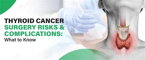 Thyroid Cancer Surgery Risks And Complications What To Know
