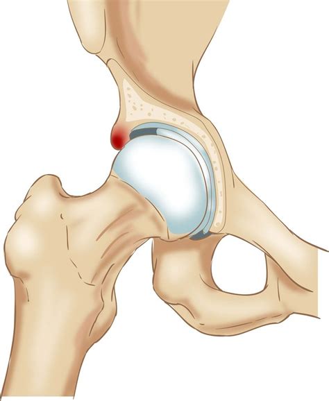 The All New Faber Test — Chiroup