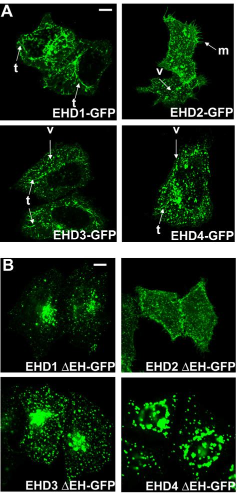 differential subcellular localization patterns of human ehd proteins