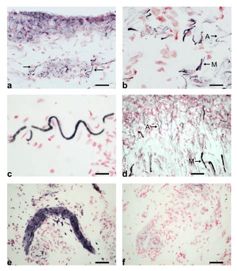 Trpm8 Immunoreactivity In Human Urinary Bladder And Dental Pulp Trpm8