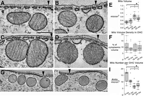 Altered Outer Hair Cell Mitochondrial And Subsurface Cisternae
