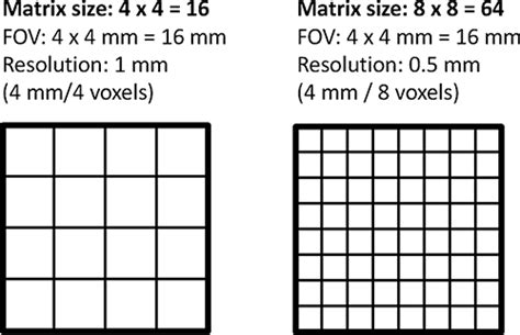 Mr Image Quality Radiology Cafe