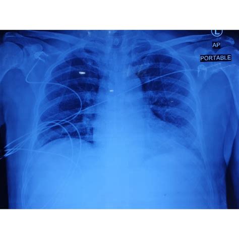 Health Screening Package Male Female Shopee Malaysia