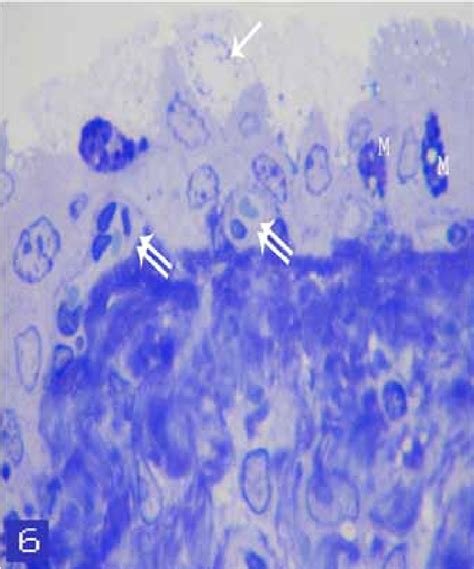 An Umbrella Superficial Cell With Karyolytic Nucleus ↑ Together With Download Scientific