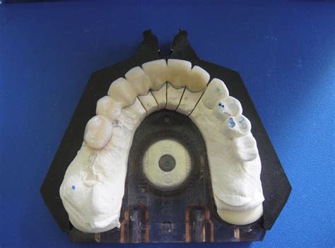 Referencie Na Práce So Systémom Sklenených Pilierov Zx 27