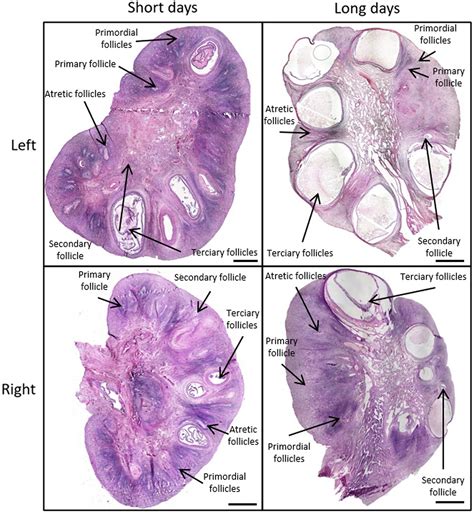 Ovary Histology Labeled
