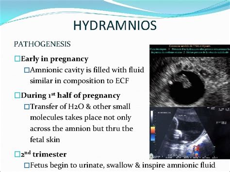 Lecture 18 Abnormalities Of Fetal Membranes Amniotic Fluid