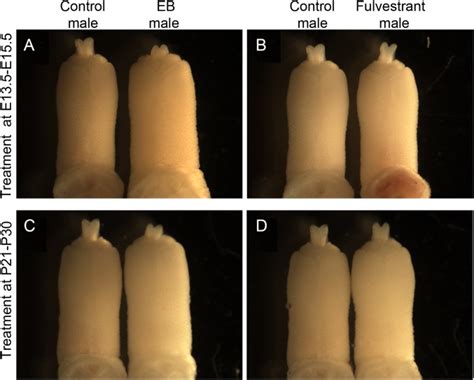 Timing Of Androgen Receptor Disruption And Estrogen Exposure Underlies