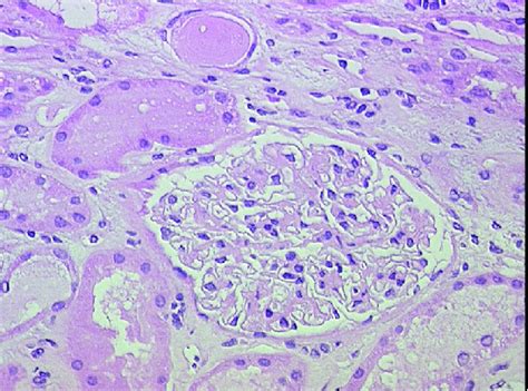 Light Microscopy Image Evidencing A Normal Glomerulus Slight
