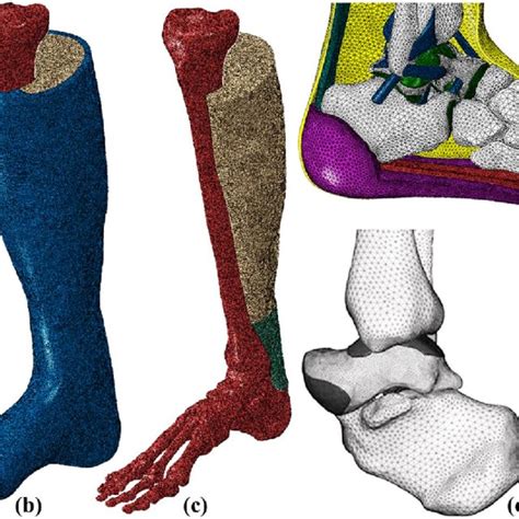 Virtual Solid And Finite Element Modelling Of The Lower Limb A Download Scientific Diagram