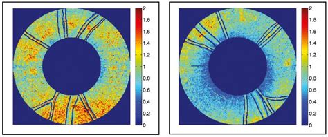 Polarization Sensitive Oct Device Could Enable Earlier Glaucoma