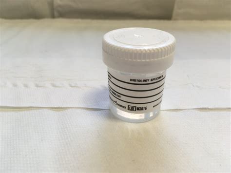 Formalin Filled Specimen Containers Cellular Pathology Exeter