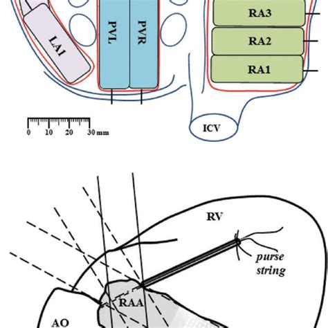 Epicardial And Endo Epicardial Mapping Schemes Upper Panel Posterior