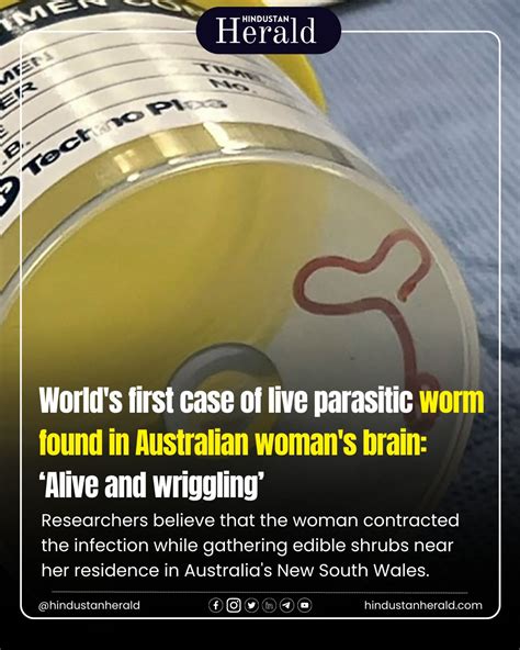 Hindustan Herald On Linkedin Hindustanherald Parasiticworm