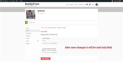 adding terms and conditions wbcom designs docs