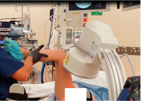 Clinical Impingement Test Performed On An Anaesthetized Patient Before