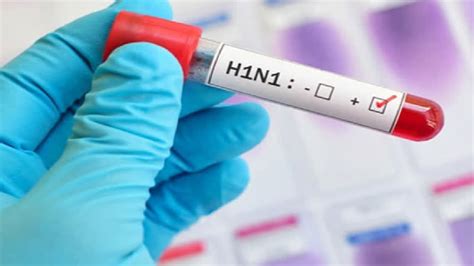 Rise In Viral Infection Private Hospitals Labs Offering Flu Testing
