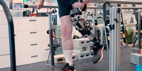 A Bionic Knee Restores Natural Movement