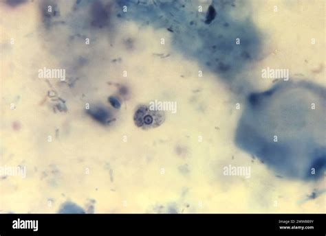 Entamoeba Polecki Trophozoite