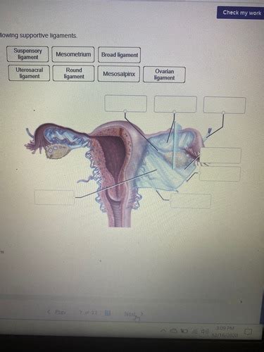 Female Reproduction System Label Ligaments Diagram Quizlet